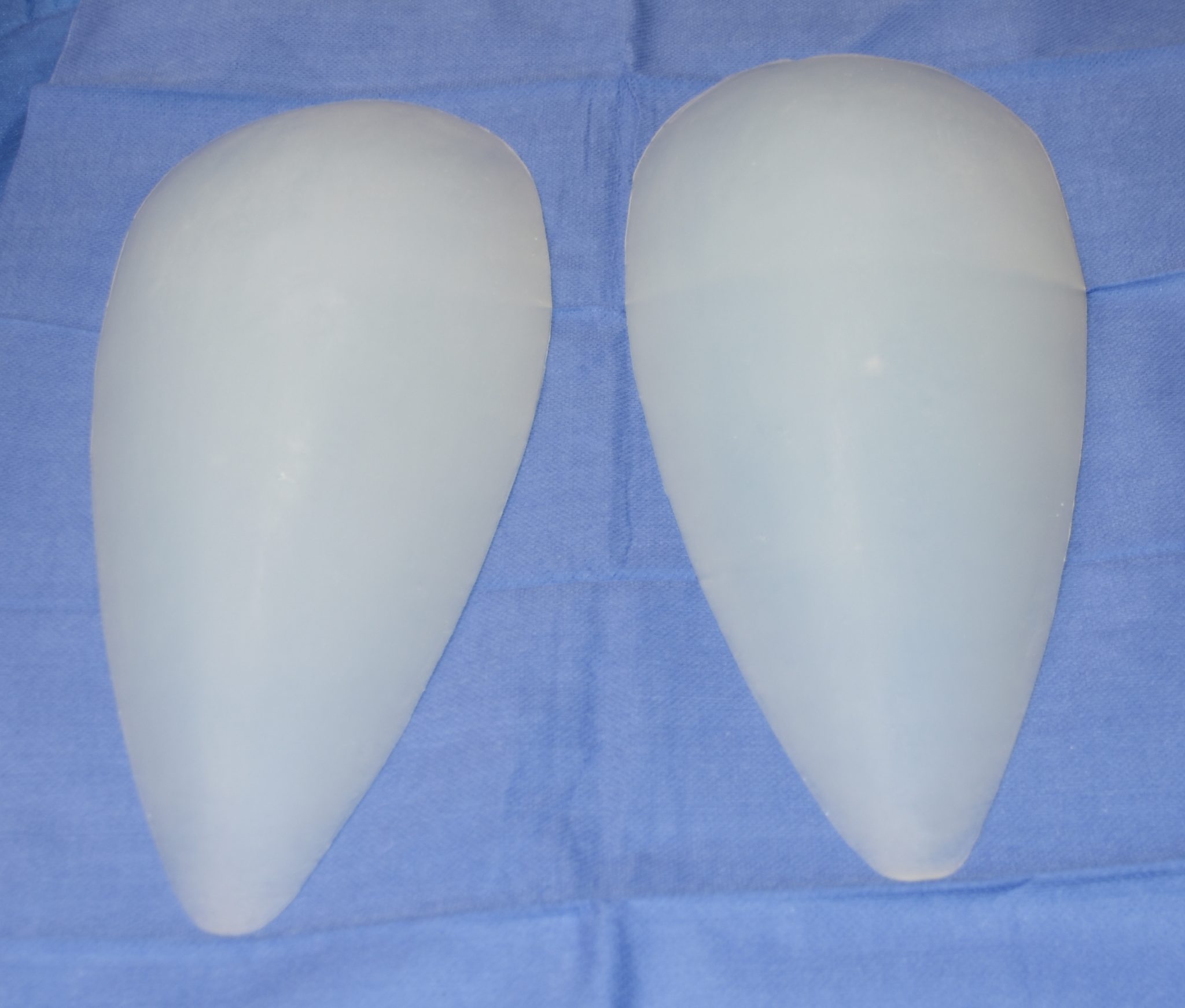 Body Implant Surgery - Body Augmentation Specialists