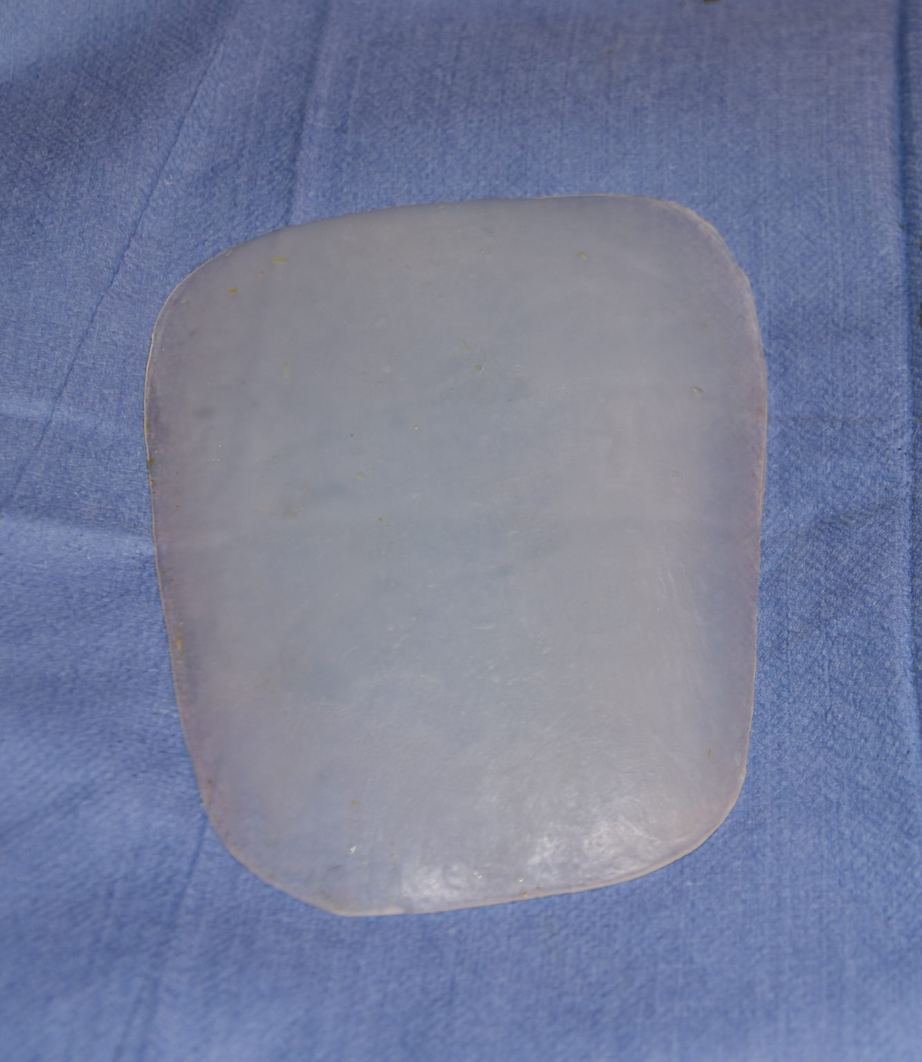 Body Implant Surgery - Body Augmentation Specialists