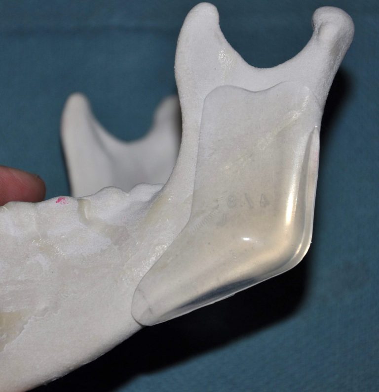 Jawline Reshaping Surgery - Jawline Enhancement