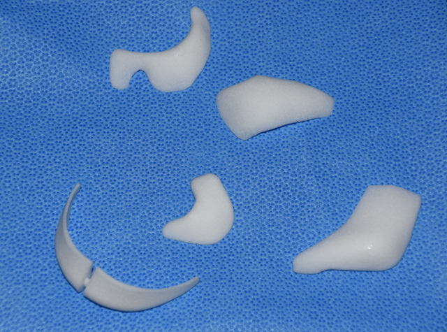 Reconstructive Facial Implant Surgeon | Dr. Barry Eppley