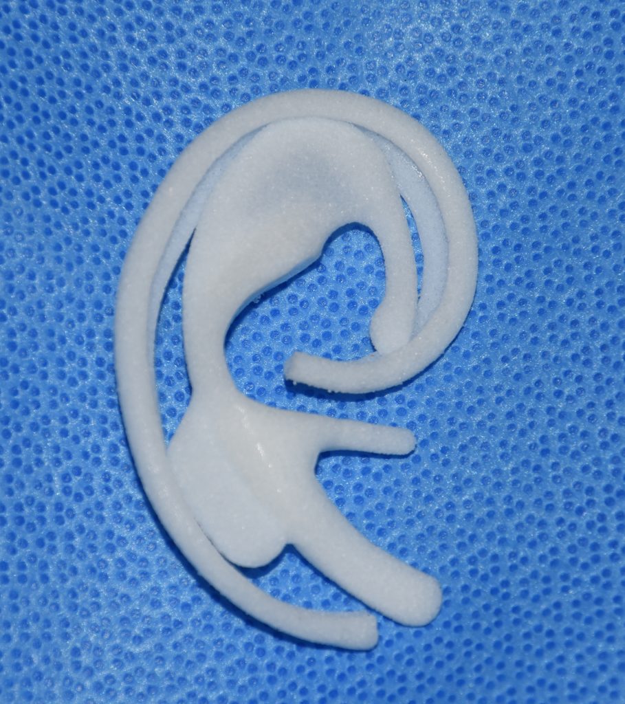 Cosmetic Ear Surgery - Top Otoplasty Surgeon