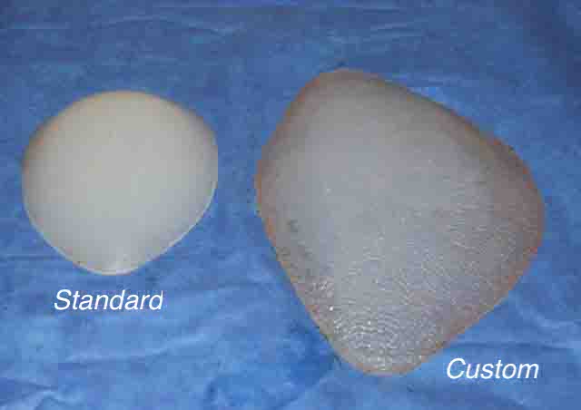 Body Implant Surgery - Body Augmentation Surgeon