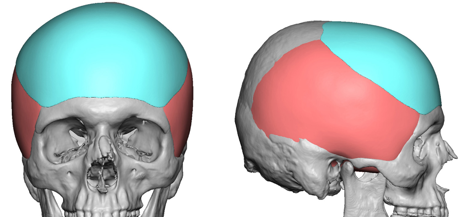Forehead Brow Bone and Temporal Contouring