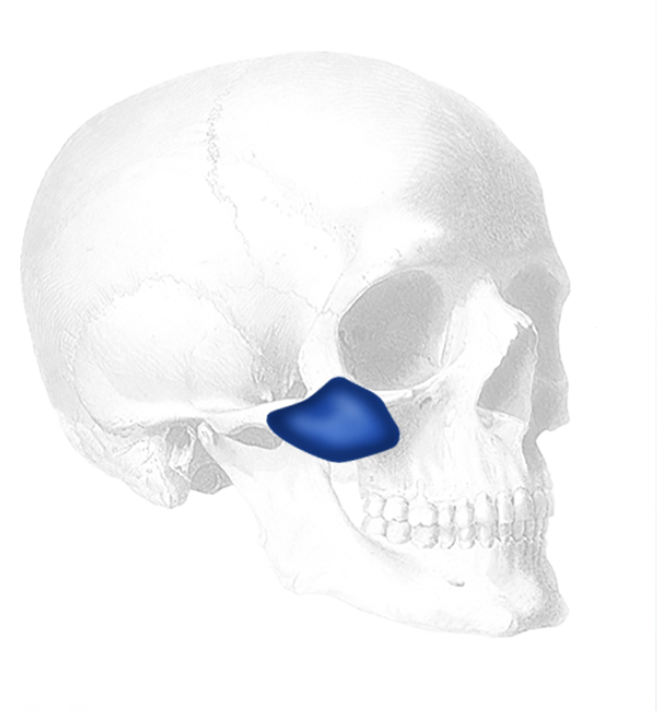 Cheek Augmentation Surgery - Cheek Implant Surgeon