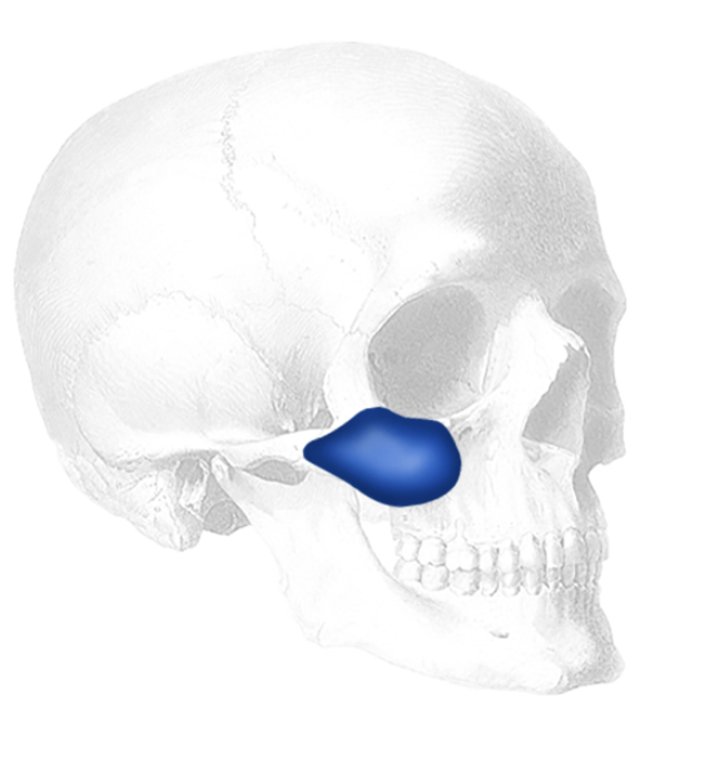 Cheek Augmentation Surgery - Cheek Implant Surgeon