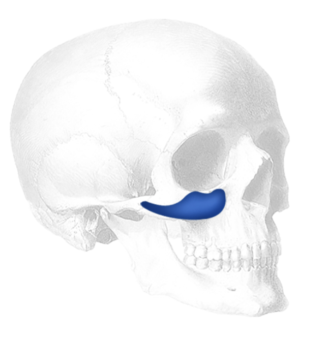 Cheek Augmentation Surgery - Cheek Implant Surgeon