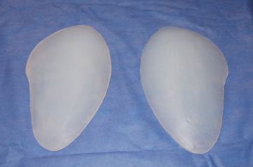 Body Implant Surgery - Body Augmentation Specialists