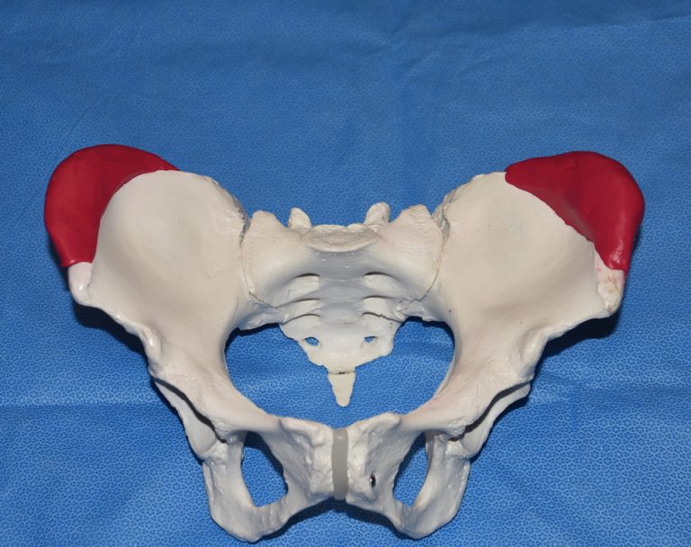 Am I A Good Candidate For Iliac Crest Implants? - Plastic Surgeon | Dr ...