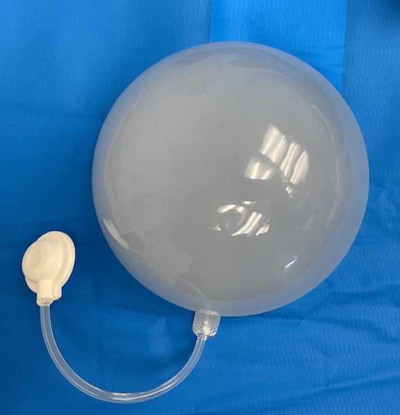 How Often Does A Scalp Tissue Expander Need to Be Filled Before Getting ...