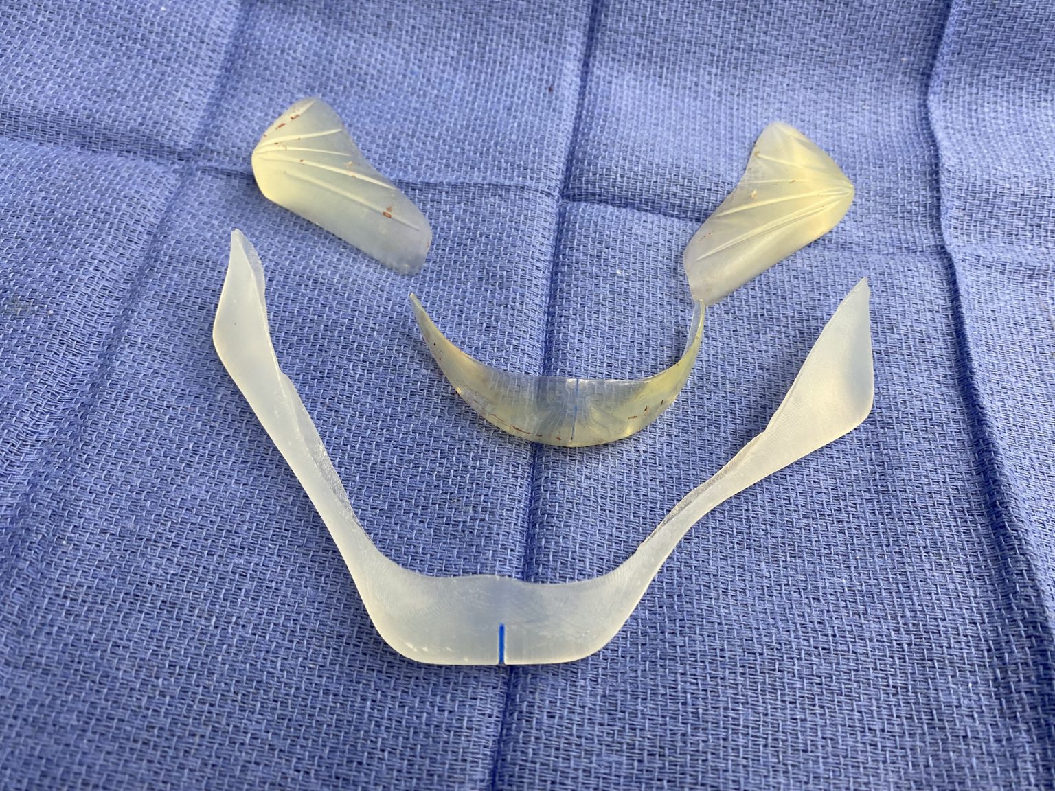 Will Standard Chin and Jaw Angle Implants Create A Smooth and ...