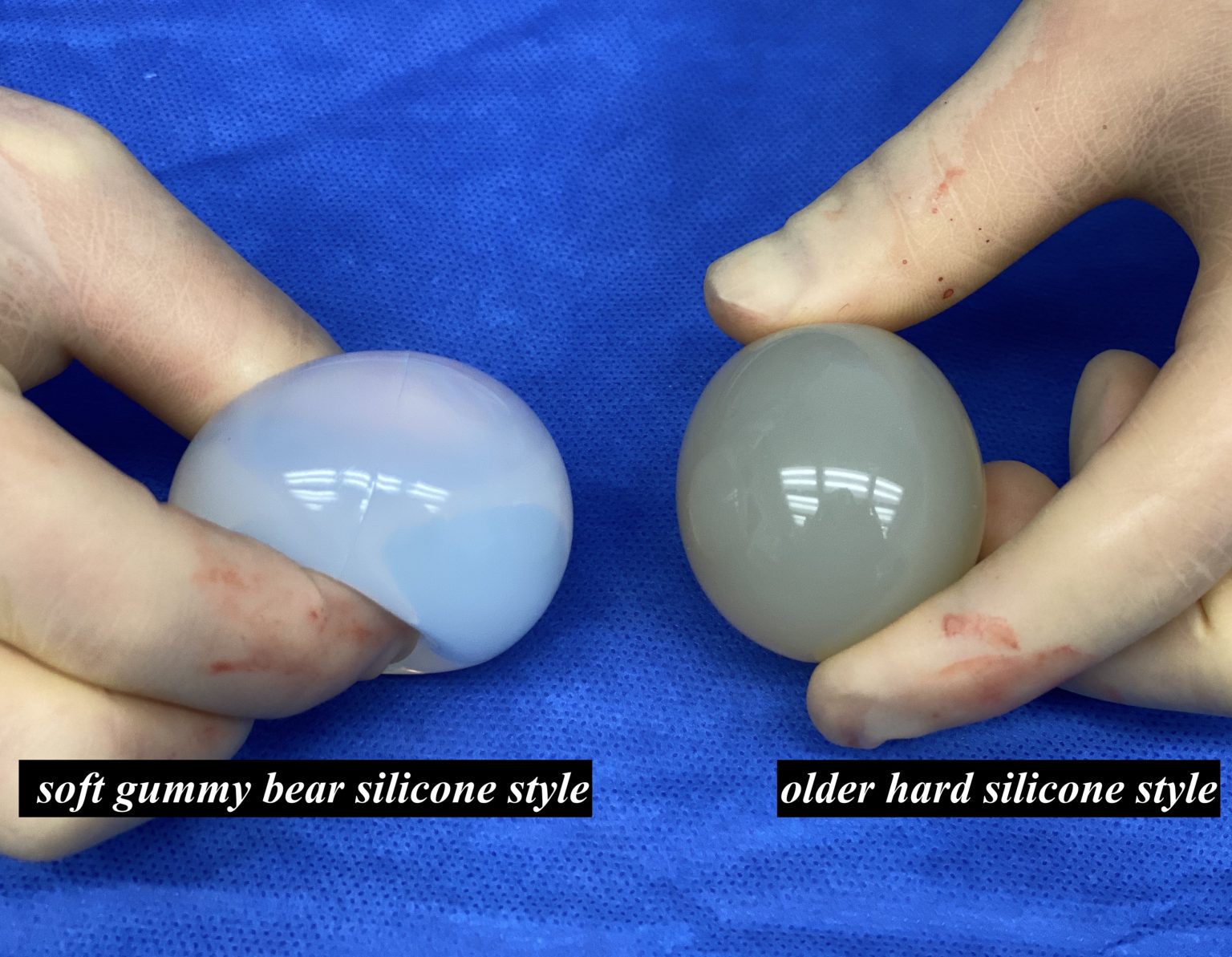 How Can I Improve The Feel Of A Hard Testicle Implant? - Plastic ...