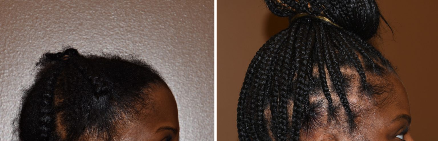 Can I Make My Skull A Lot Bigger? - Plastic Surgeon | Dr. Barry L ...