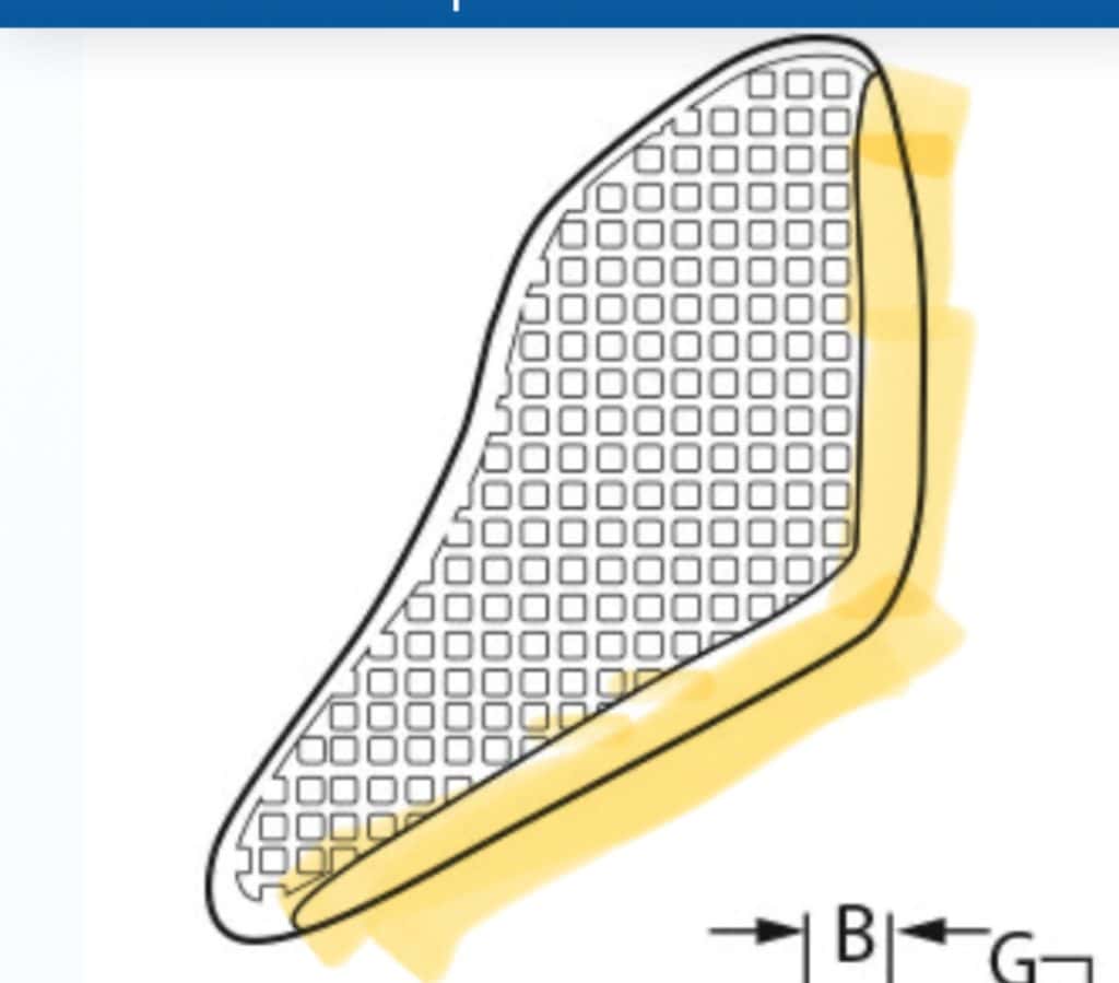 What Is The Best Jaw Angle Implants? - Plastic Surgeon | Dr. Barry L ...