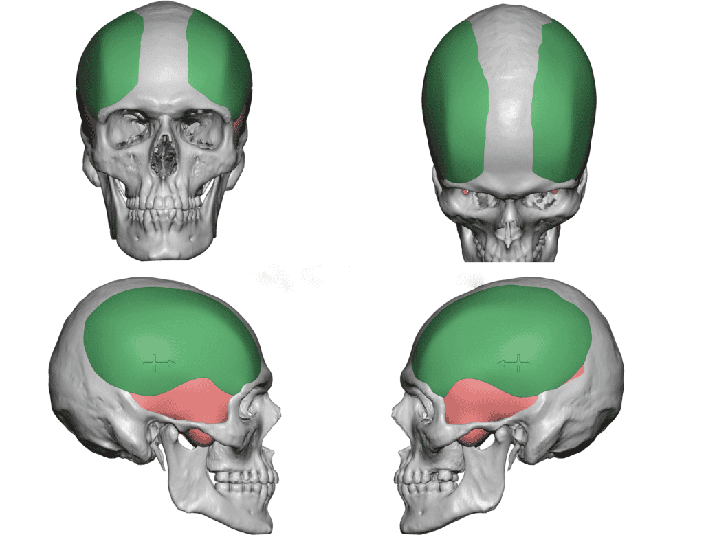 How Can I Make The Sides Of My Head Wider To Better Match My Wider ...