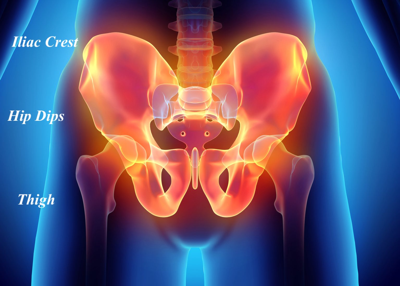 Body Implant Surgery - Body Augmentation Surgeon