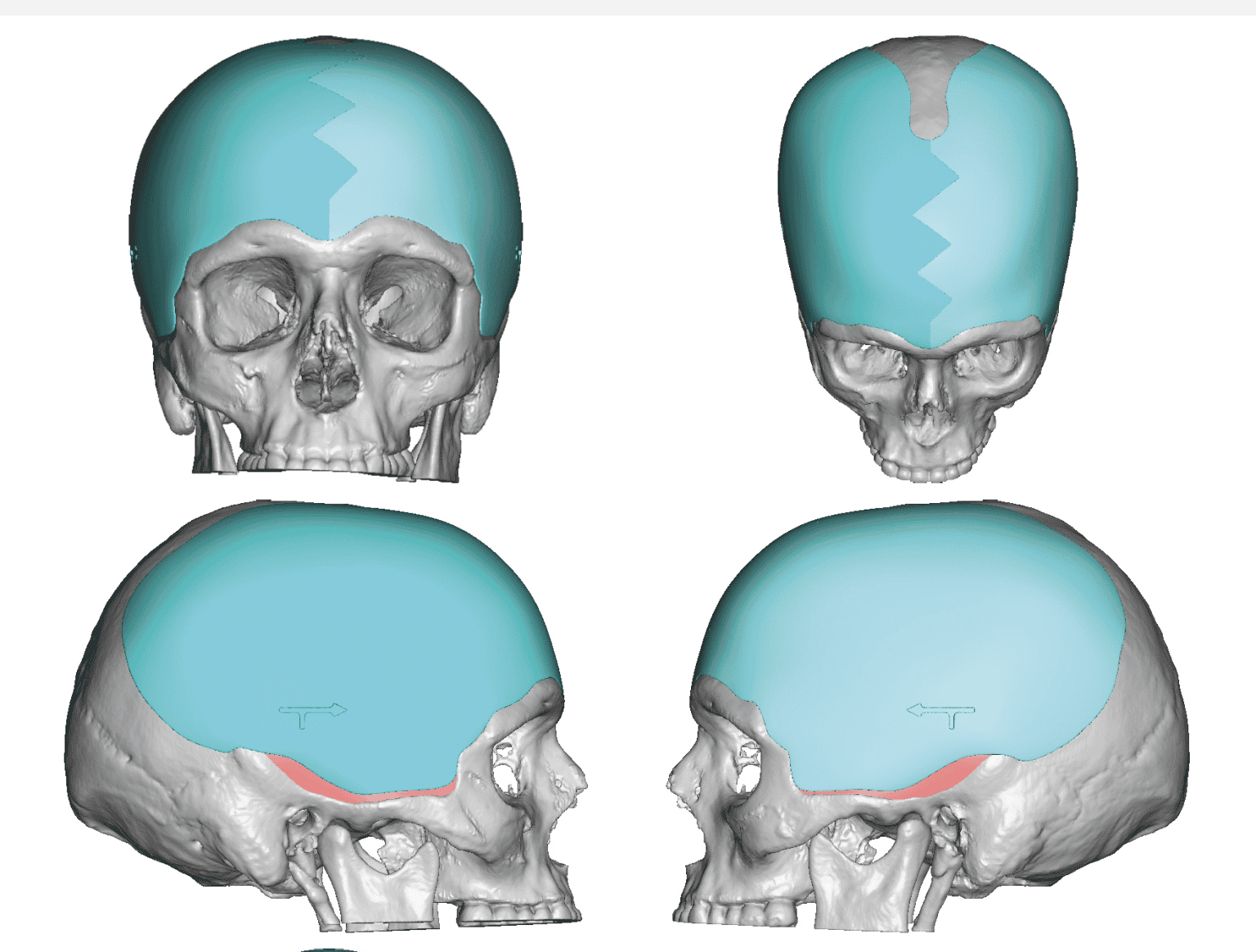 How Can I Make My Head Wider and Taller? - Plastic Surgeon | Dr. Barry ...