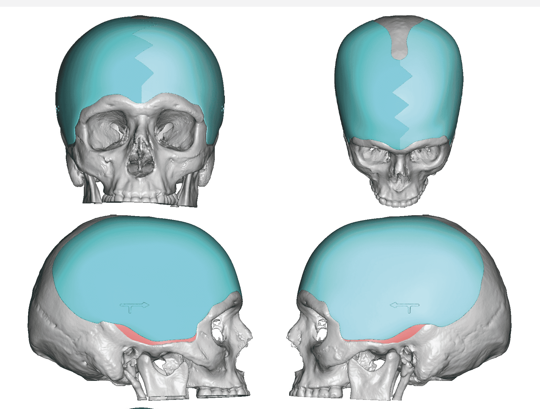 How Can I Make My Head Wider and Taller? - Plastic Surgeon | Dr. Barry ...